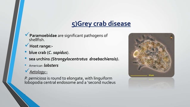 Shell fish parasitic disease | PPTX