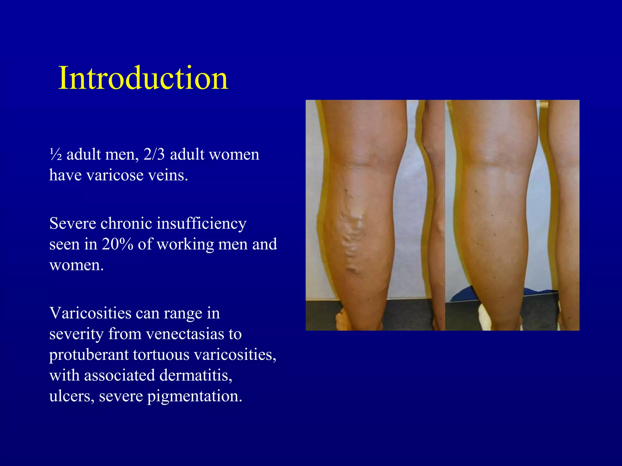 Management of Incompetence in the Axial Veins | PPTX