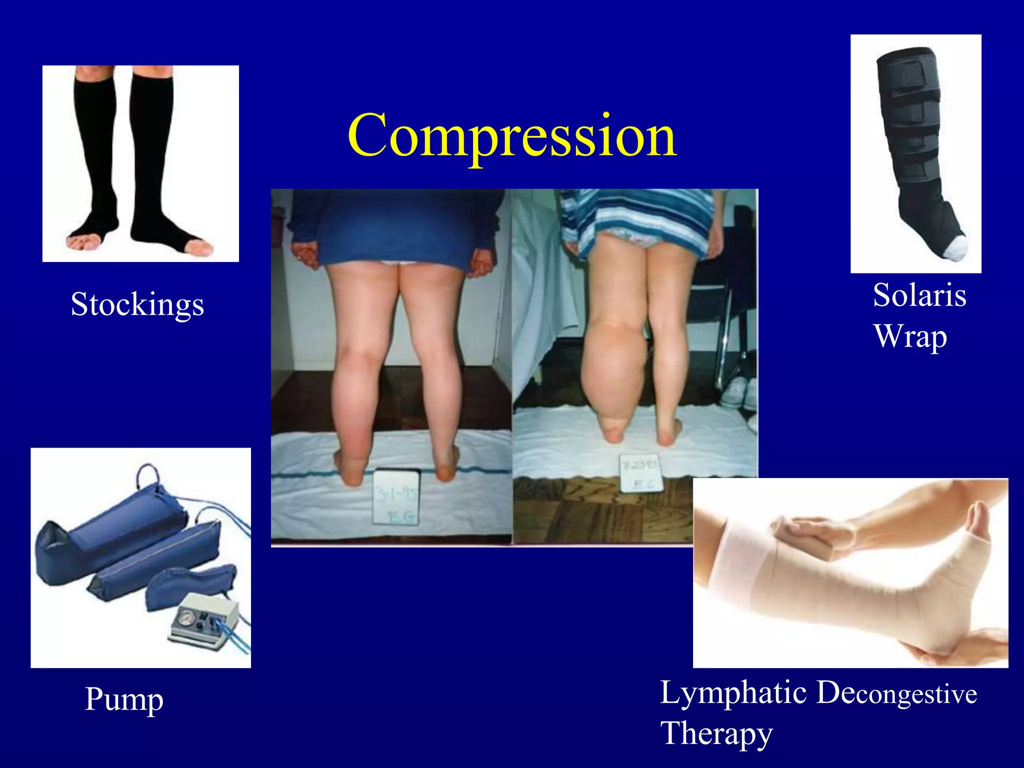 Management of Incompetence in the Axial Veins | PPTX | Digestive ...