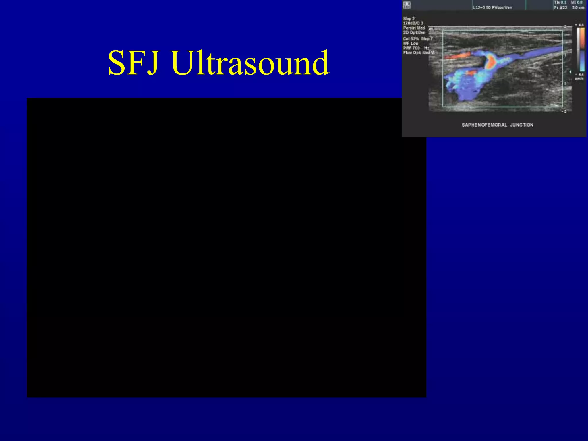 Management of Incompetence in the Axial Veins | PPTX