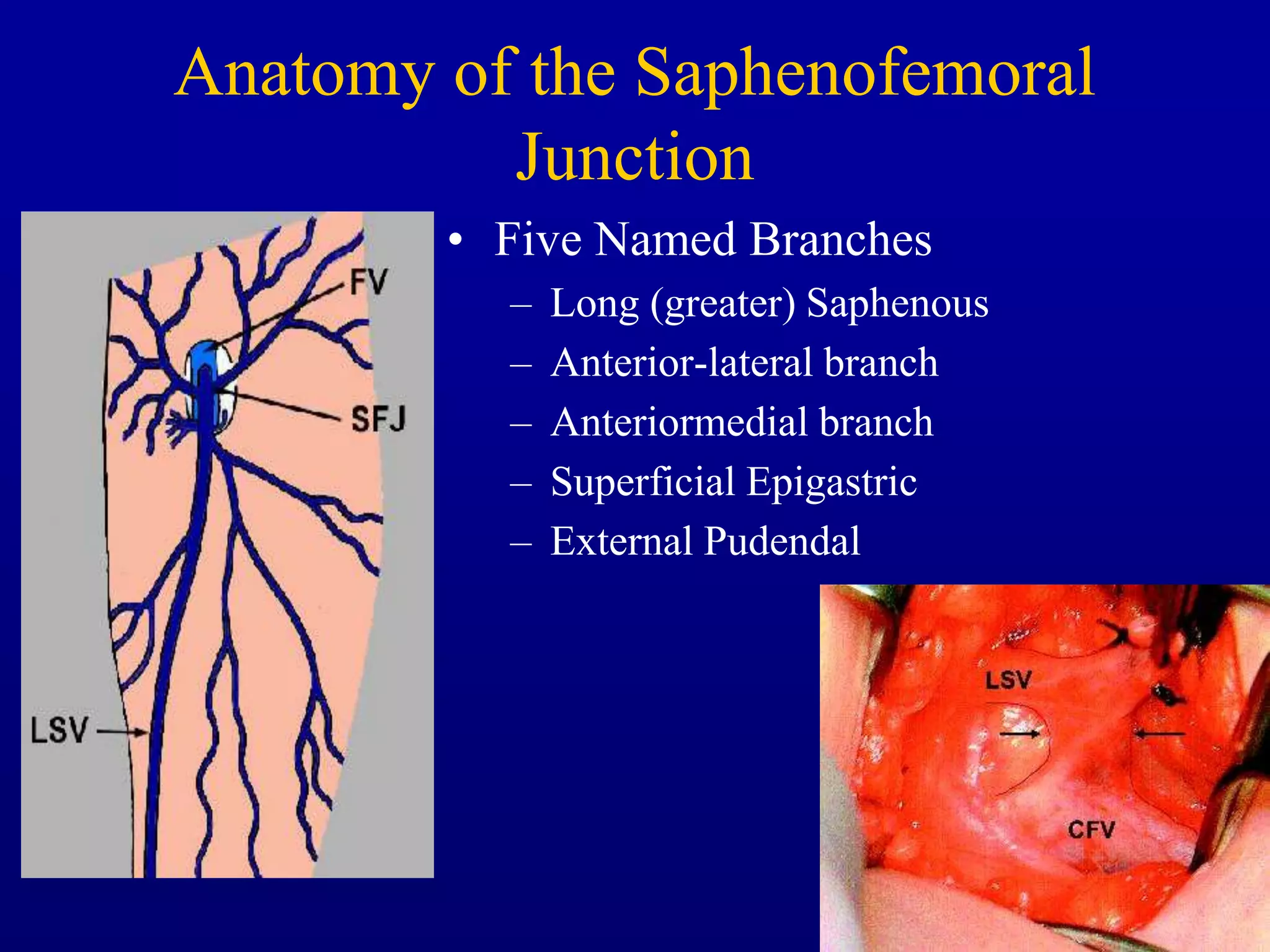 Management Of Incompetence In The Axial Veins Pptx