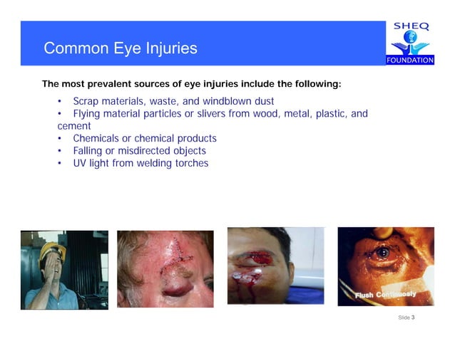 Sheq foundation eye safety | PPT