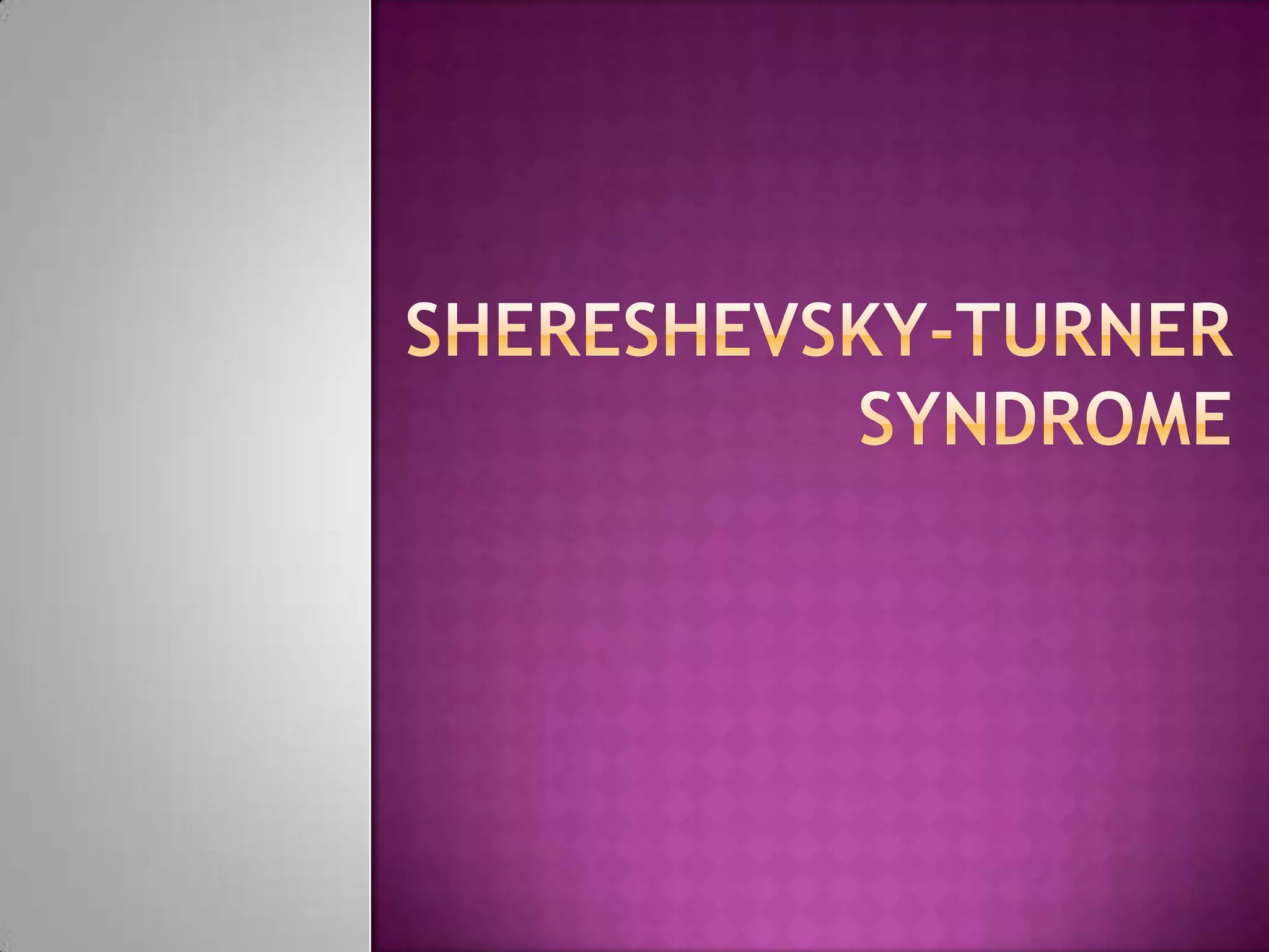 Shereshevsky turner syndrome | PPTX
