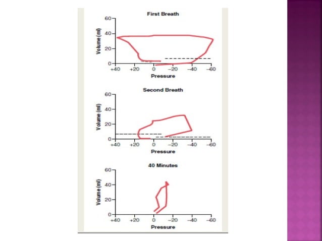 neonatal physiology | PPT