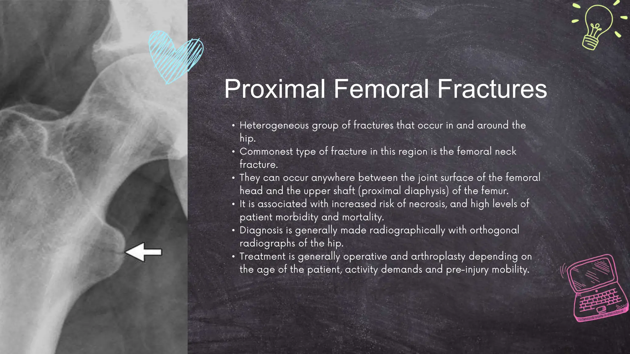 Proximal femur fracture classification ppt | PPTX