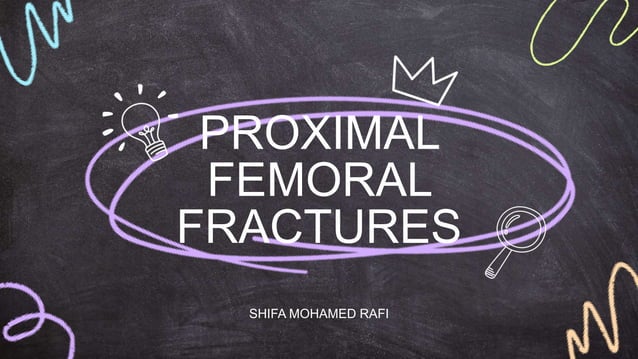 Proximal femur fracture classification ppt | PPT | Free Download