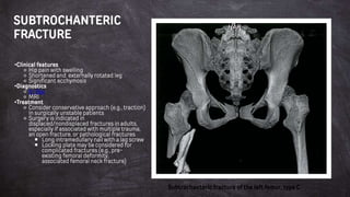 Proximal femur fracture classification ppt | PPTX