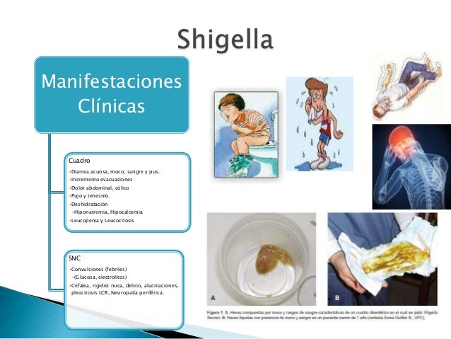 Shigella