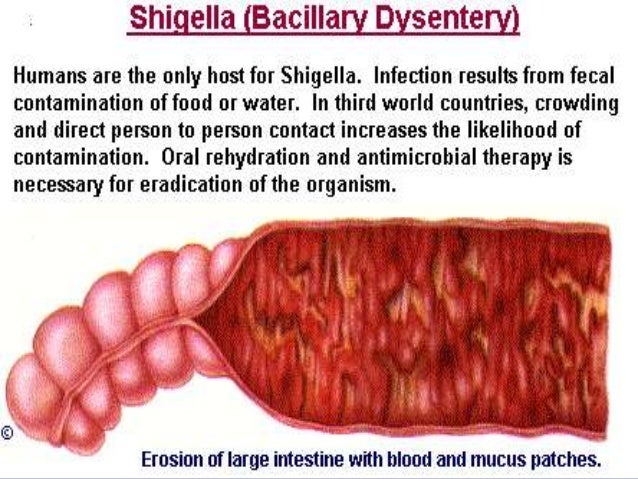 Shigella