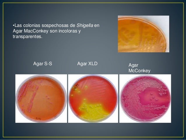 Shigella