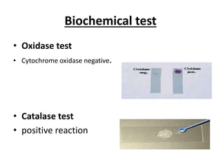 Shigella | PPTX