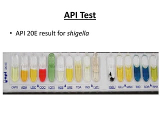 Shigella | PPTX