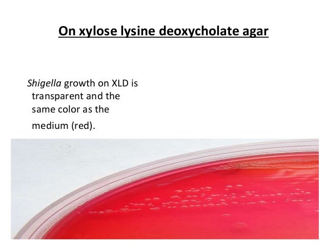 Xld Agar Shigella