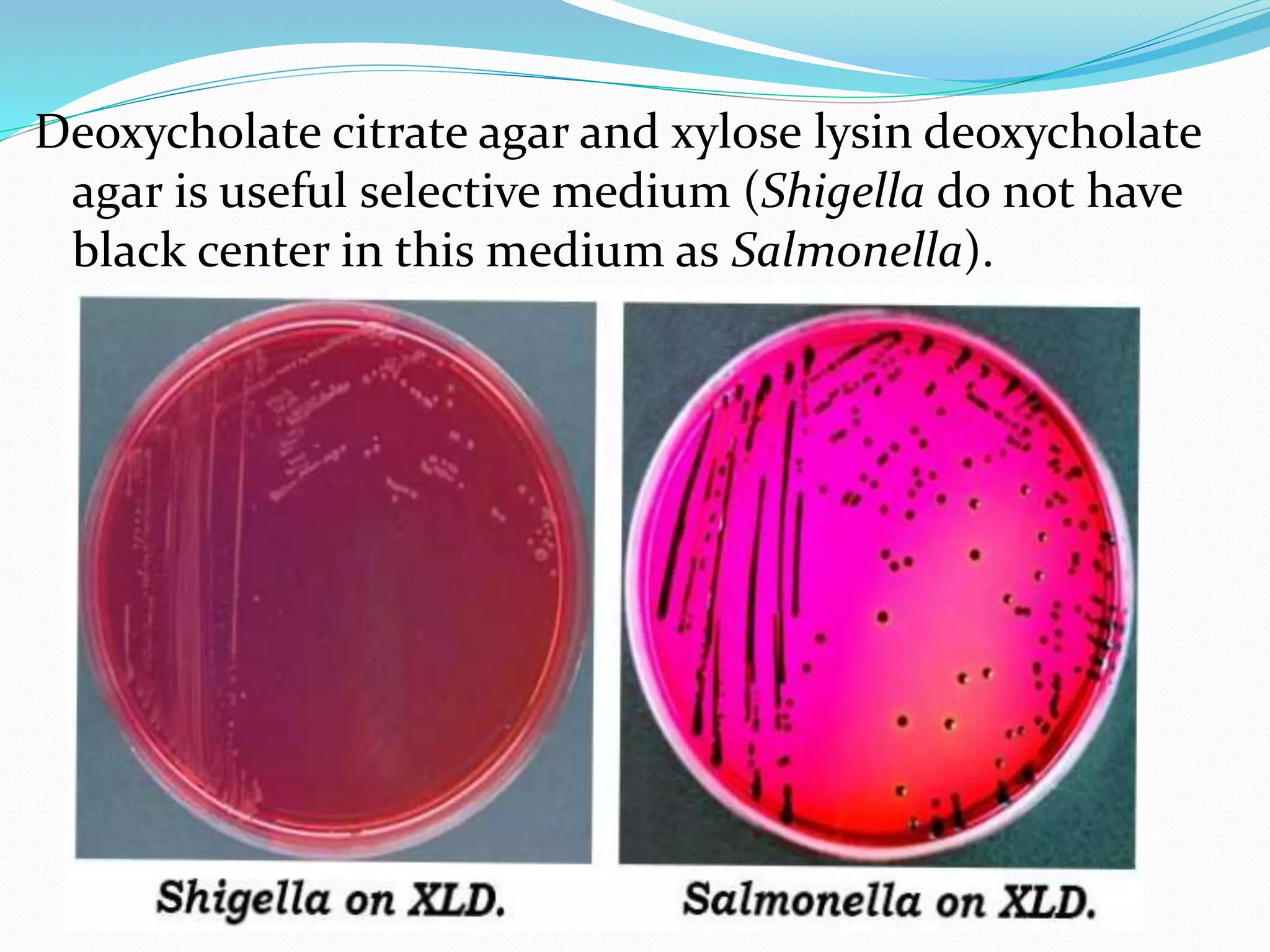 Shigella | PPTX