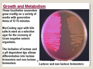 Shigella and food poisoning | PPT