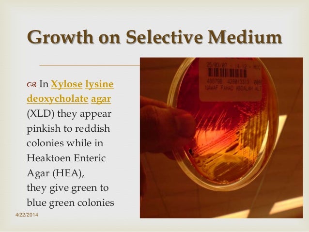 Xylose Lysine Deoxycholate Xld Agar Inoculated With