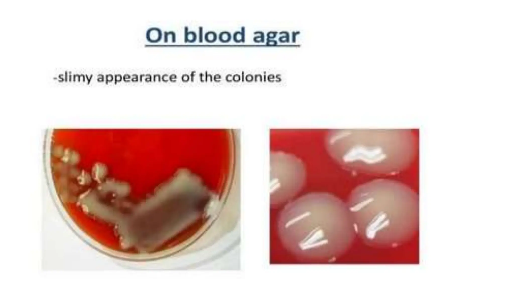 Shigella Klebsiella Proteus Pseudomonas Pptx