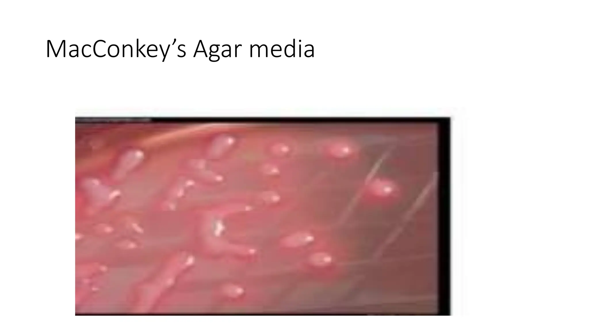 SHIGELLA, KLEBSIELLA, PROTEUS, PSEUDOMONAS.pptx