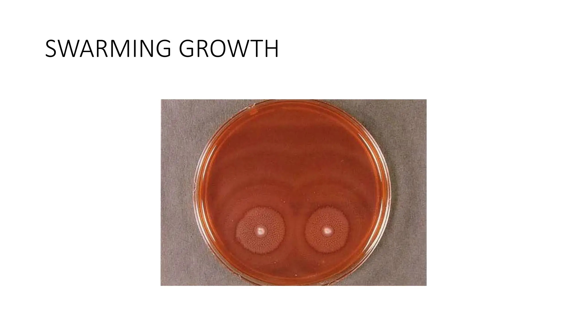 SHIGELLA, KLEBSIELLA, PROTEUS, PSEUDOMONAS.pptx