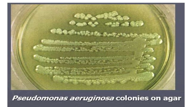 SHIGELLA, KLEBSIELLA, PROTEUS, PSEUDOMONAS.pptx