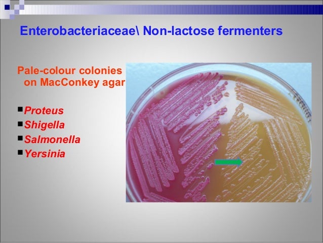 Shigella, salmonella & yersinia