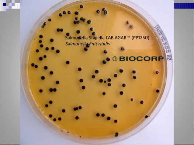 Shigella, salmonella & yersinia