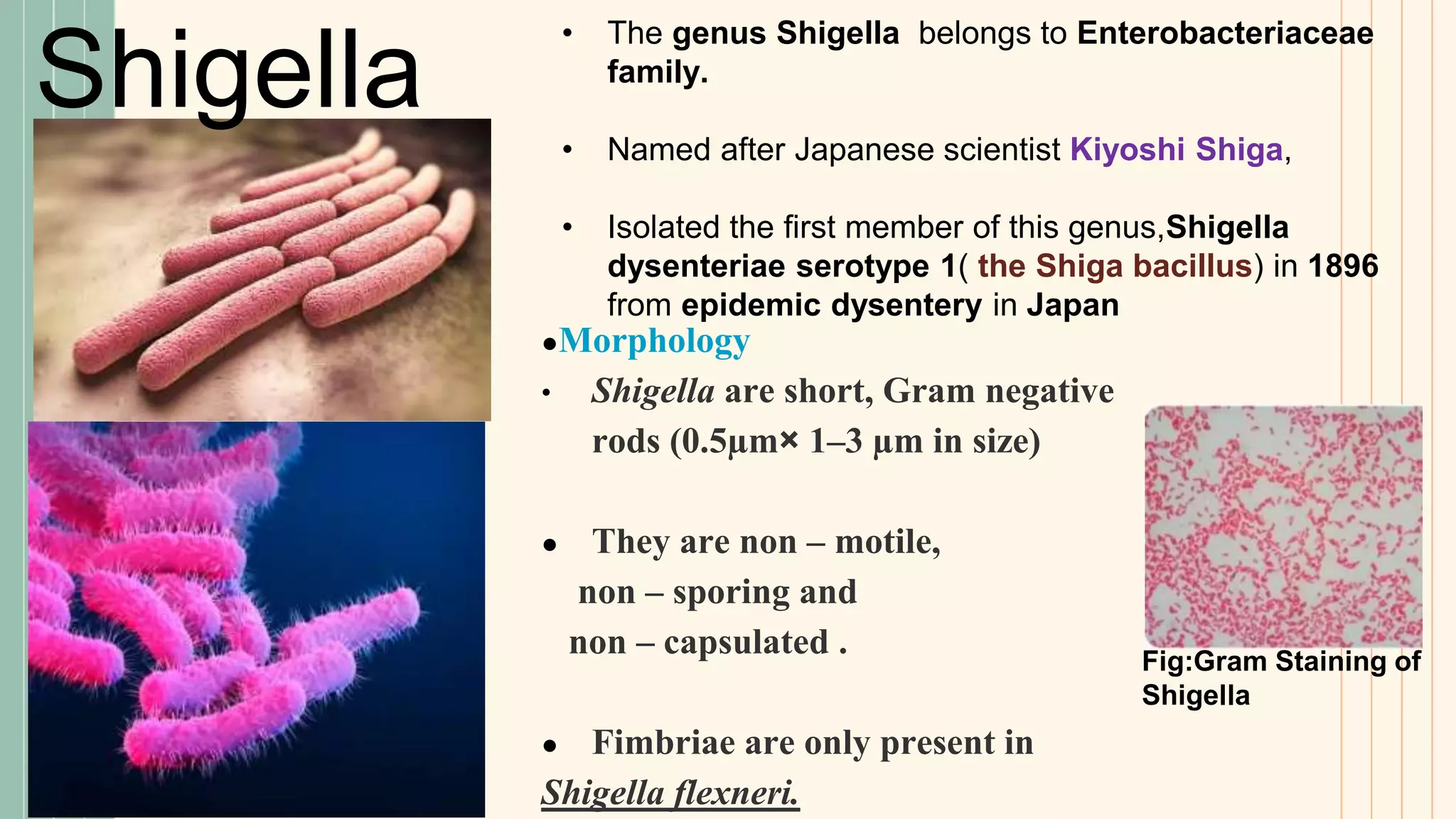 shigellosis.pptx