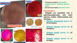 shigellosis.pptx