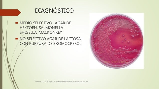 Resumen Shigelosis Epidemiología Cuadro Clínico Dx y Tratamiento