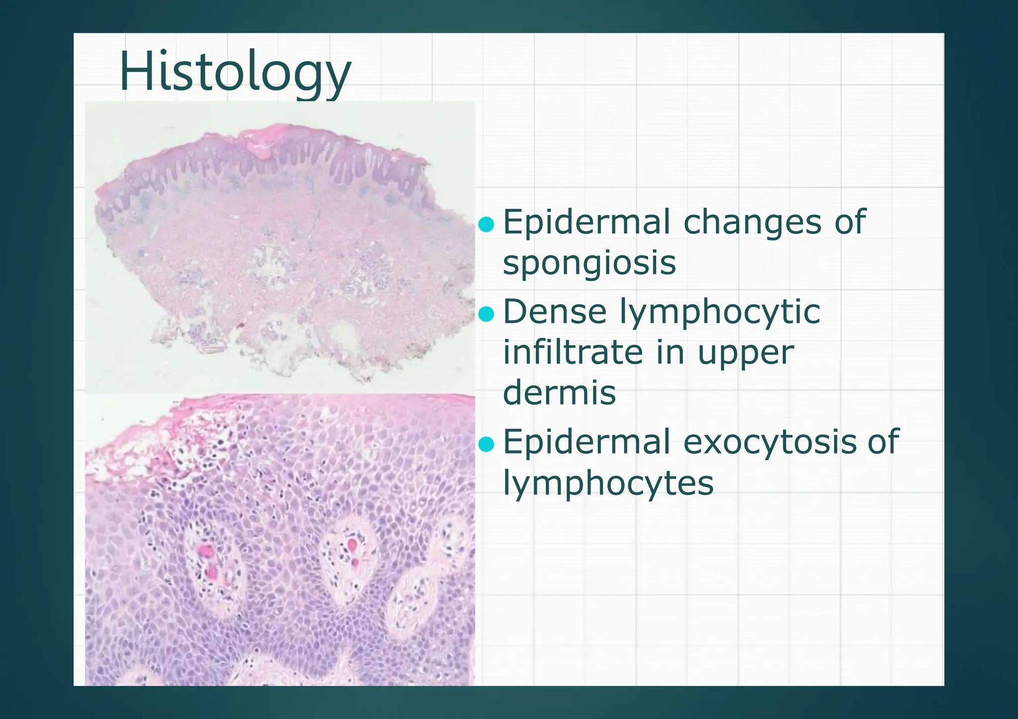Allergic contact dermatitis shikhar.pptx
