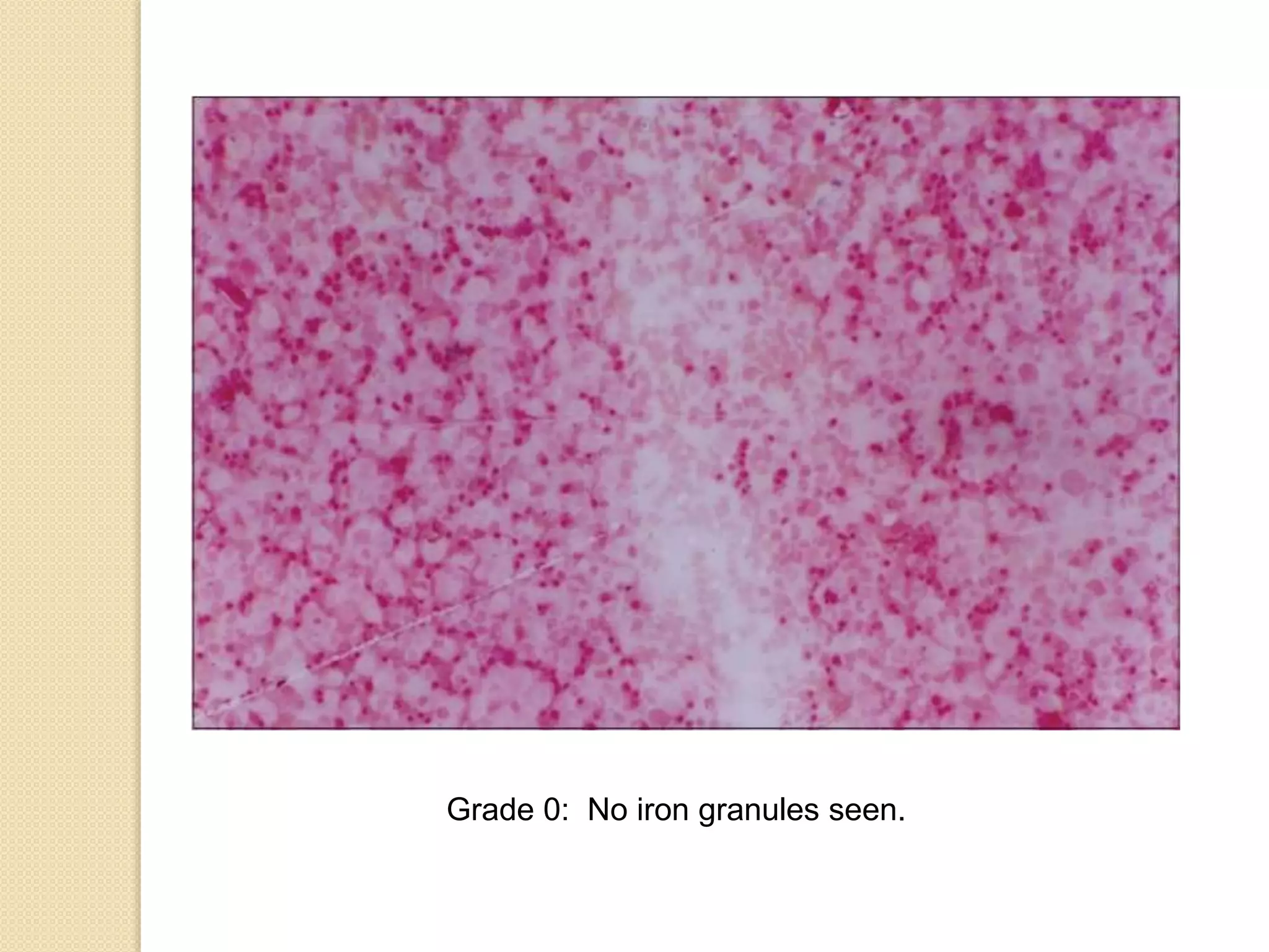 iron staining. | PPTX