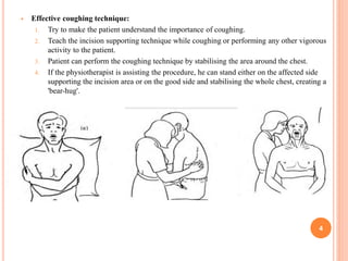 PT in thoracic surgery | PPTX