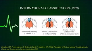 CLEFT LIP AND PALATE | PPTX
