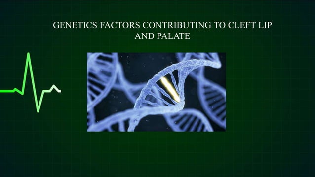 CLEFT LIP AND PALATE | PPT