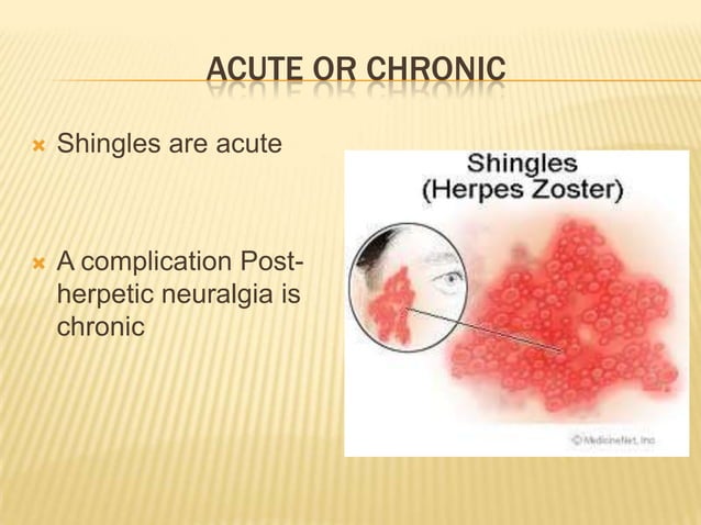 Shingles | PPTX | Infectious Diseases | Diseases and Conditions