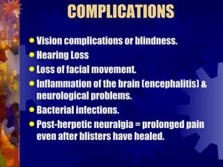 Shingles | PPT