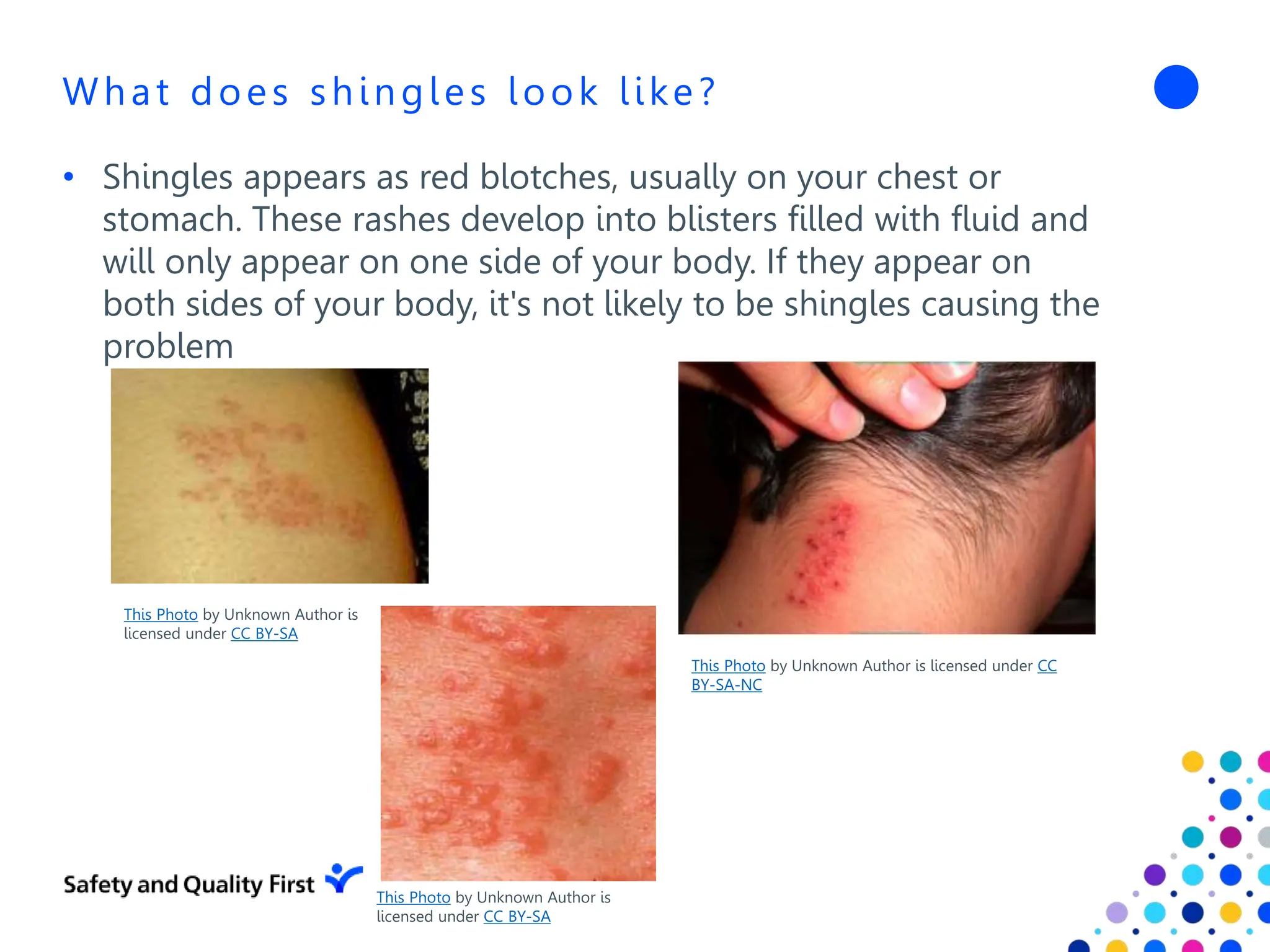 The Shingles Diseases Presentation.pptx
