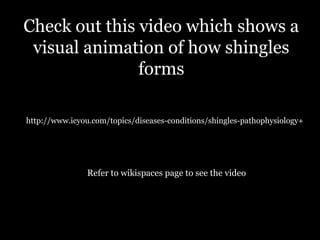 Shingles for human phys | PPT | Free Download