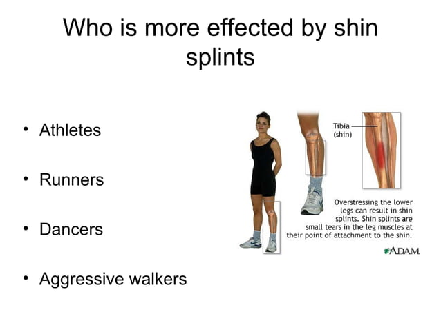 Shin Splints | PPT