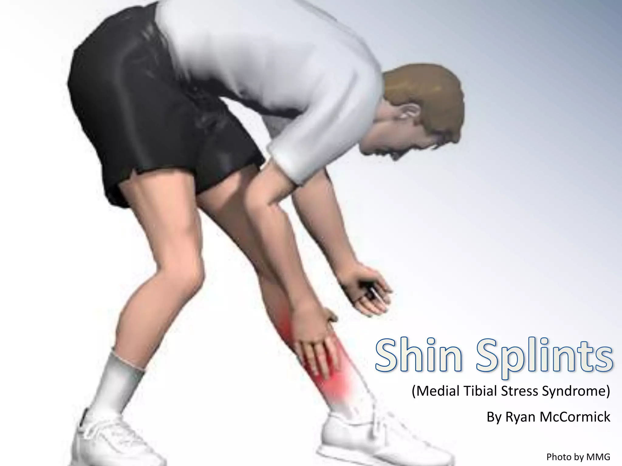 Shin Splint Presentation | PPTX