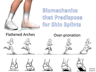 Shin Splint Presentation | PPTX