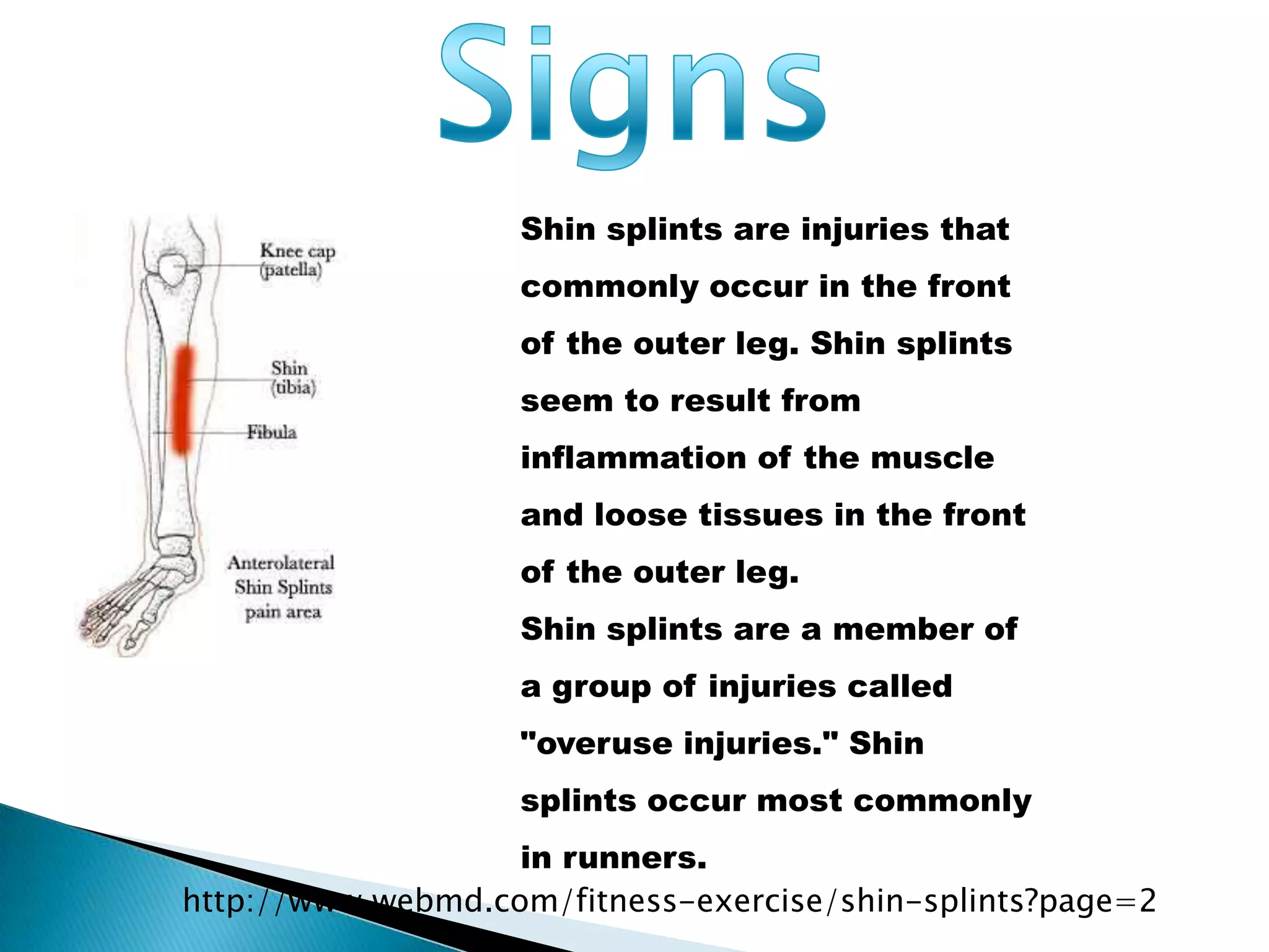 Shin splints powerpoint | PPTX