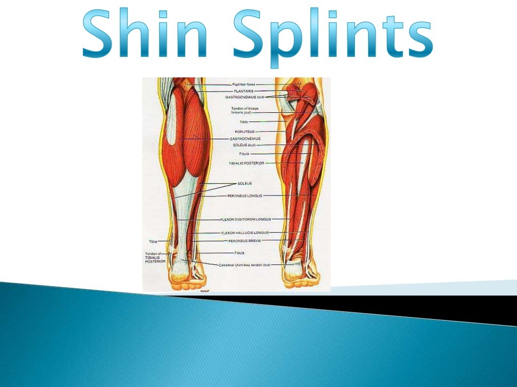 Shin splints powerpoint