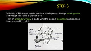 Shirodkar sling surgery | PPTX