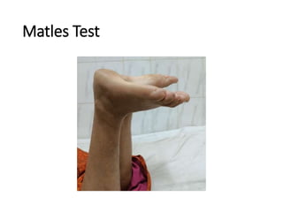 Shishir...TA Rupture.pptx