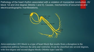 Pathology of Heart and in its conduction. | PPT