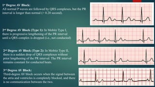 Pathology of Heart and in its conduction. | PPTX