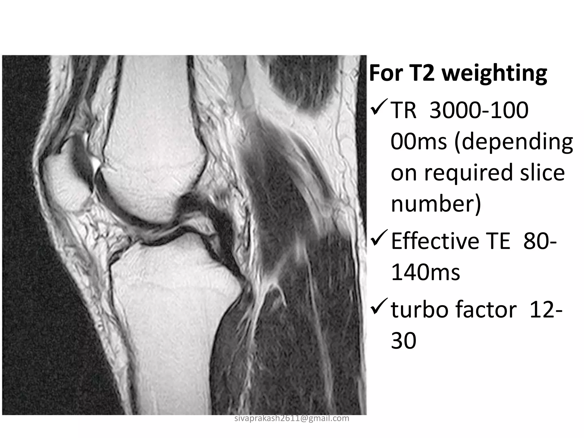 MRI spin echo pulse sequences | PPTX
