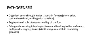 maduramycosis | PPTX