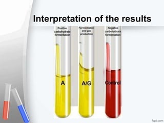 Sugar fermentation tests, Cetrimide agar medium, Hugh Leifson medium | PPTX